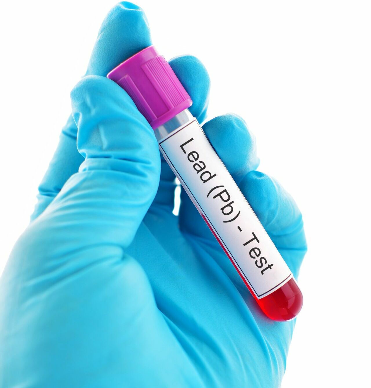 Indy organizations partner to raise awareness about lead poisoning ...